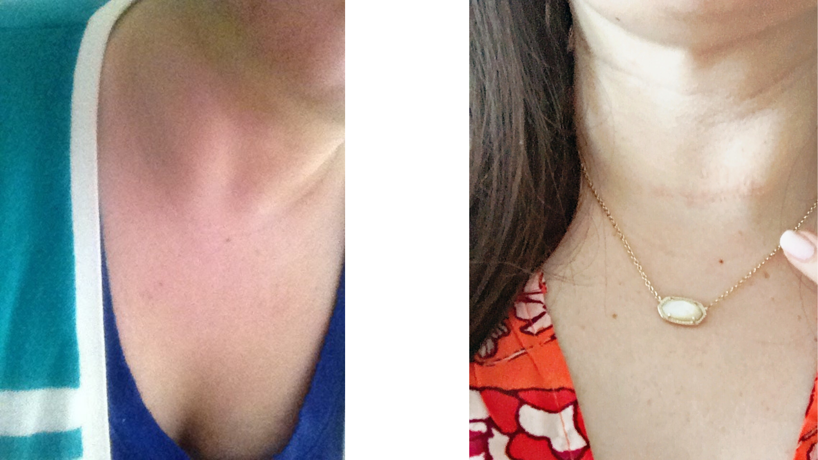 I advocated for my health. Here’s how. - Prevent Cancer Foundation