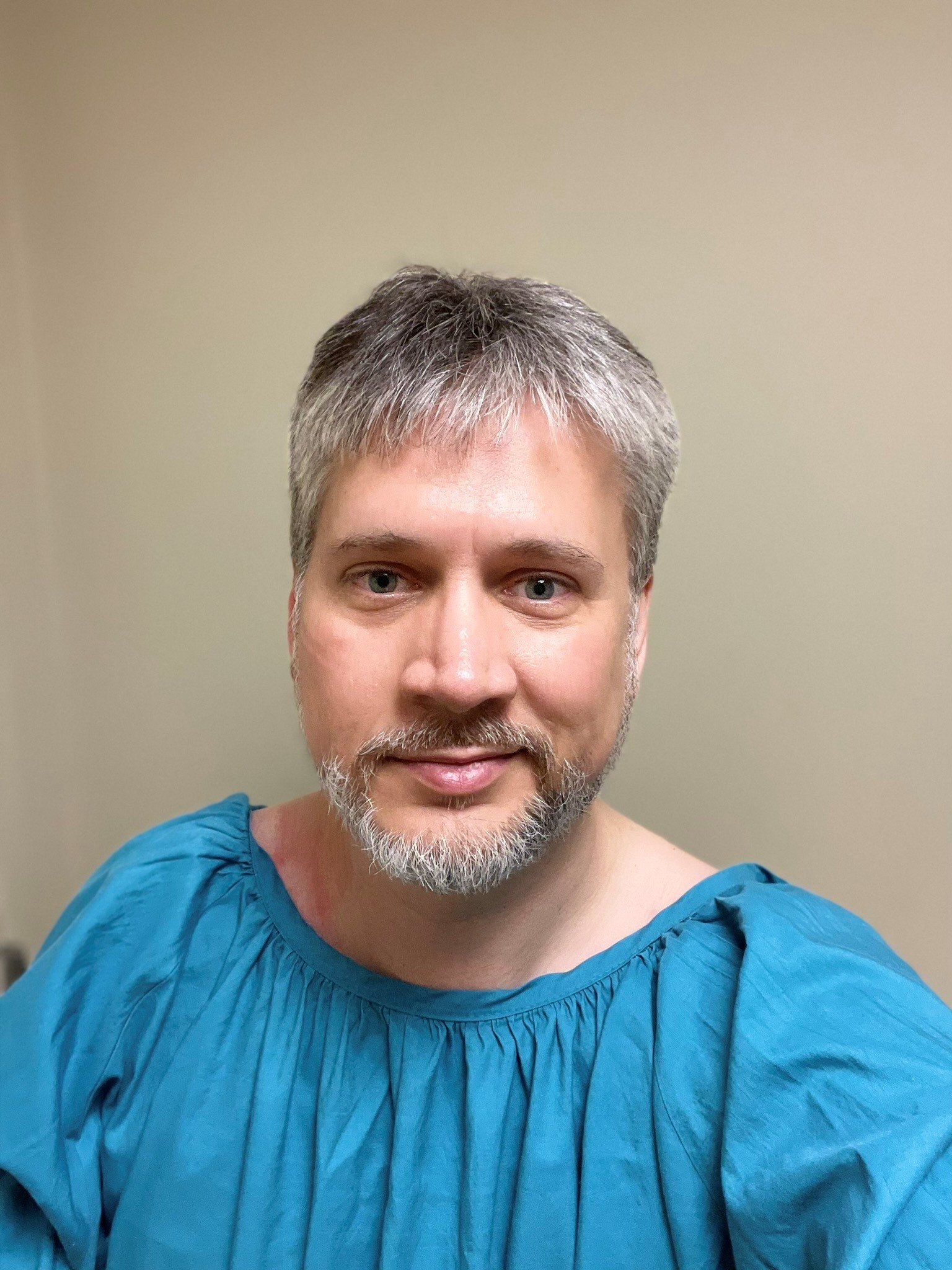 My first colonoscopy: How it went and what they found